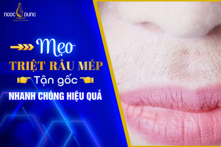 TOP 9 Cách triệt ria mép vĩnh viễn tận gốc không mọc lại