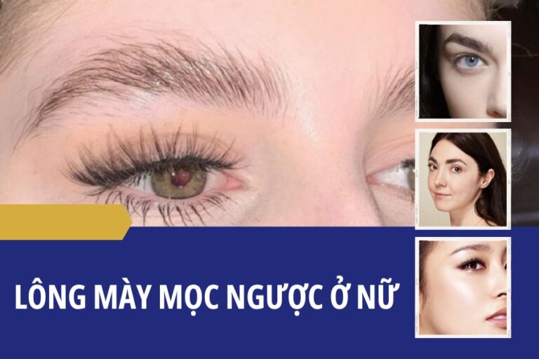 Lông mày mọc ngược là gì? Có ý nghĩa gì với nam và nữ?