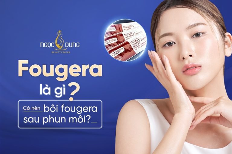 Fougera là gì? Có nên bôi fougera sau phun môi?