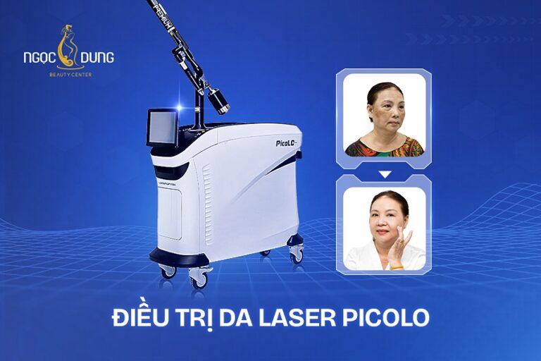 Điều trị da với Laser Picolo