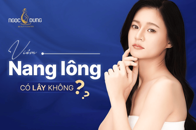 Viêm nang lông lây không? Cách trị tại TMV Ngọc Dung